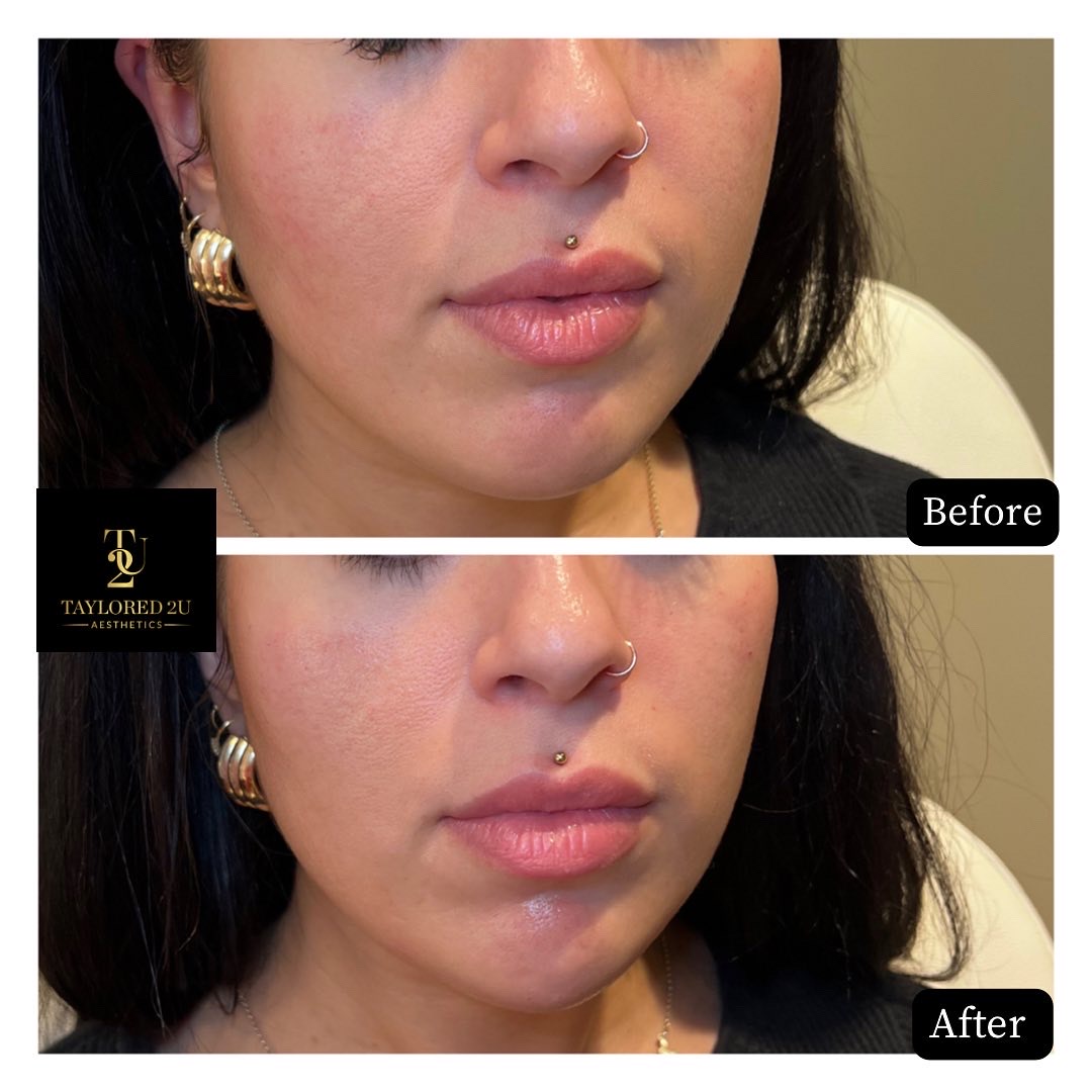 Gallery - Taylored 2 U Aesthetics